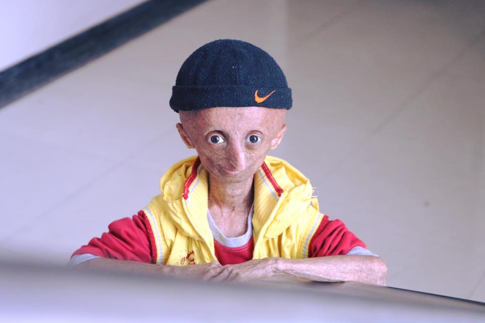 Progeria South African Artist